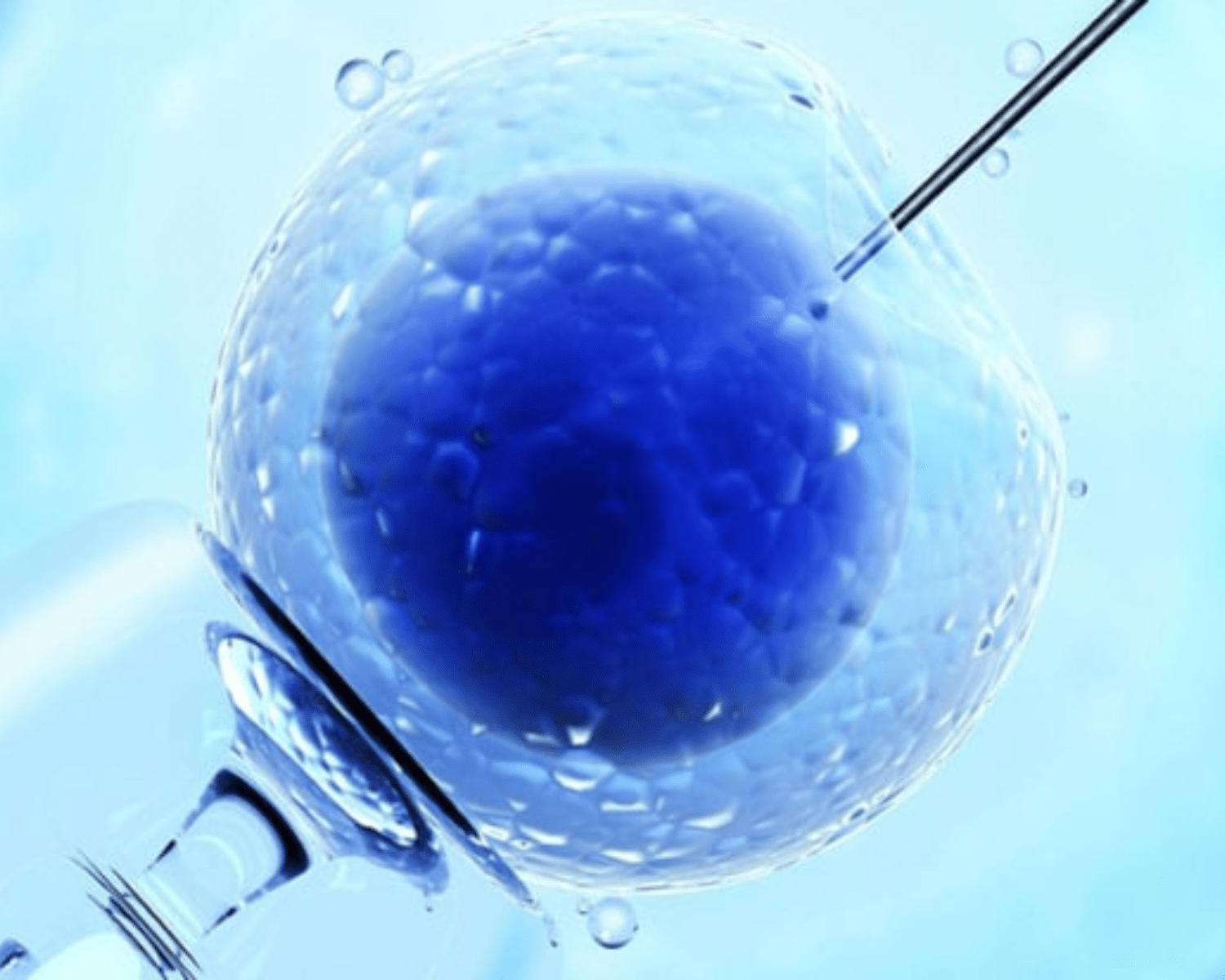 Infertility Procedures & Treatment | Australian Concept