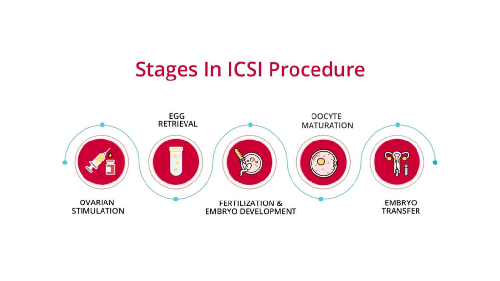 ICSI Treatment in Lahore | Cost, Procedure & Success Rate